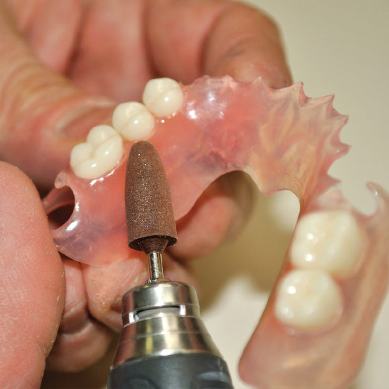 Dental Partials | Resin Partial Frames | Acrylic Partials