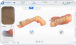 Free 3D Scanner - Sun Dental Labs